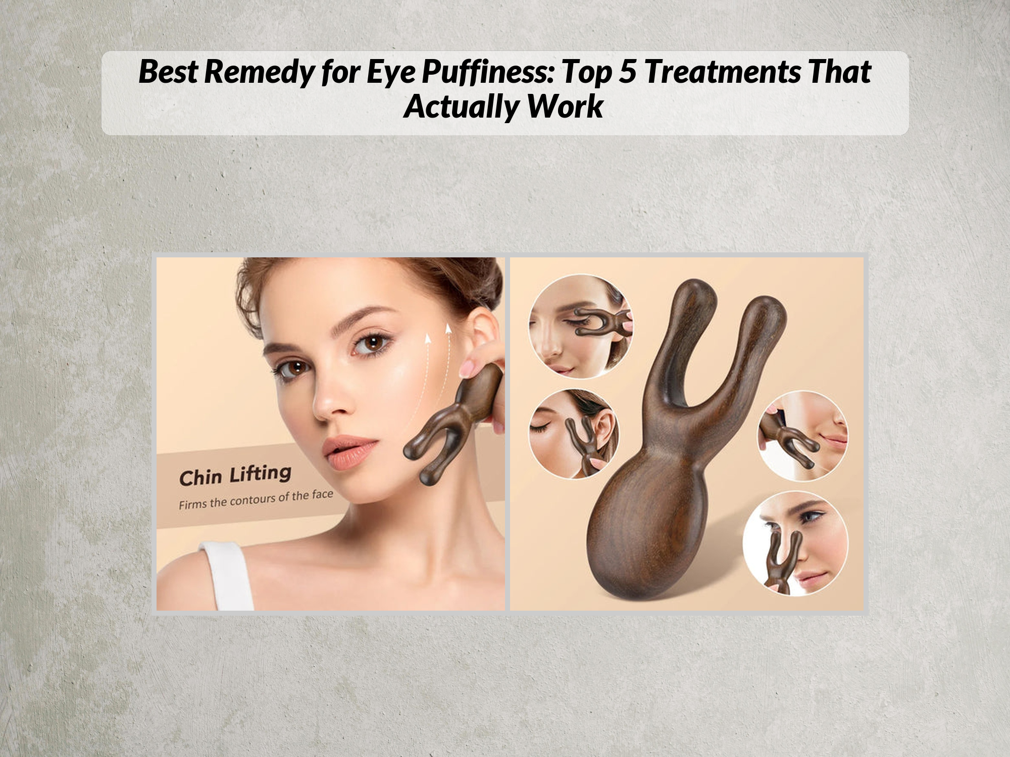 Best Remedy for Eye Puffiness: Top 5 Treatments That Actually Work ...