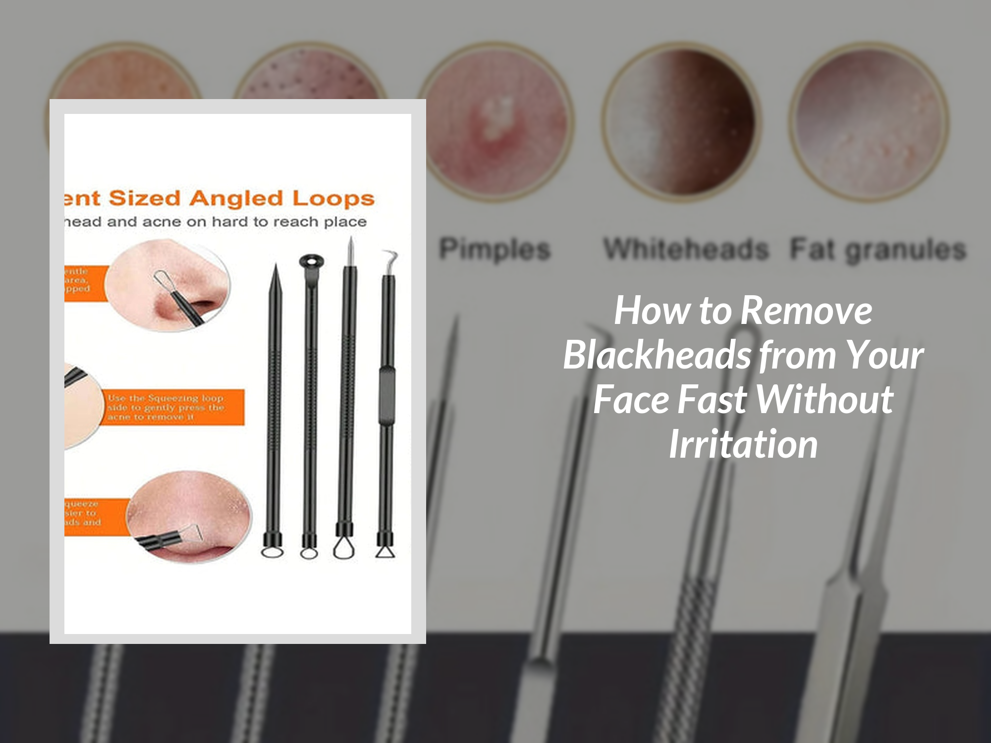 How to Remove Blackheads from Your Face Fast Without Irritation ...