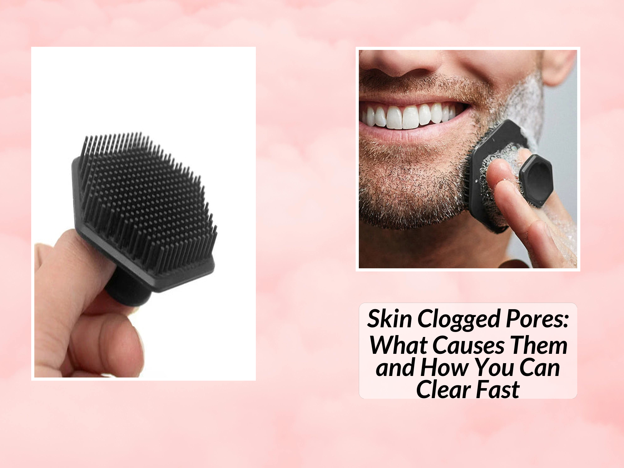 Skin Clogged Pores: What Causes Them and How You Can Clear Fast ...