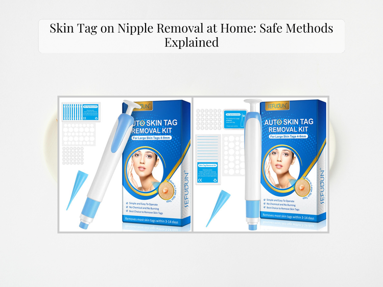 Skin Tag on Nipple Removal at Home: Does It Hurt? Freeze vs Acid ...