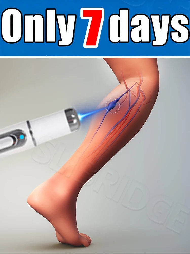 KentDO™ Blue Light Vein Finder Pen – Safer Foot Care – KentDO™ Healthy ...